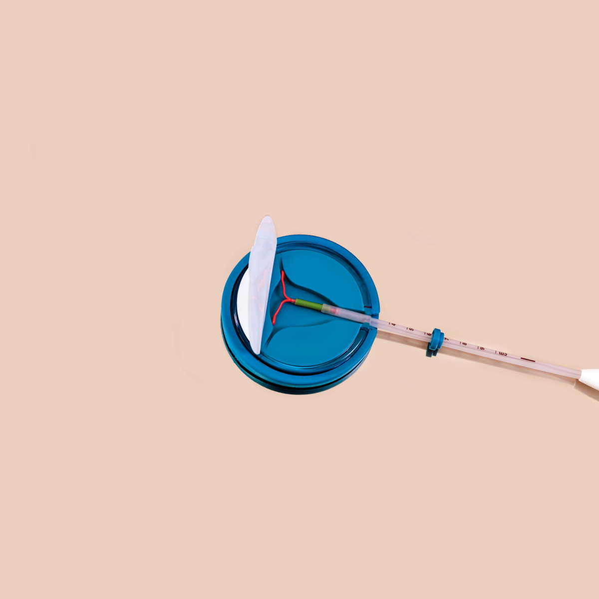 Intrauterine Device (IUD) & Intrauterine System (IUS) – Super B Blus ...
